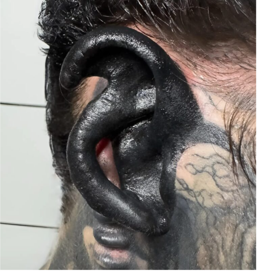 Now that's a radical transformation! This woman even keeps her removed ...