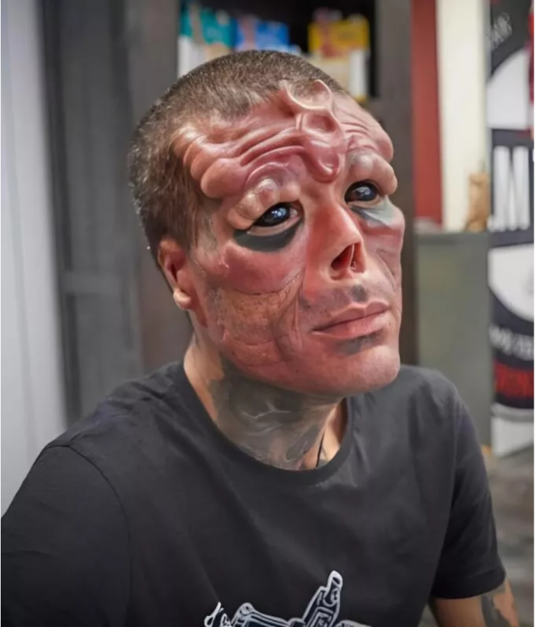 Cut off his nose, got a tattoo and implants. Why the transformation? - rasplove.com